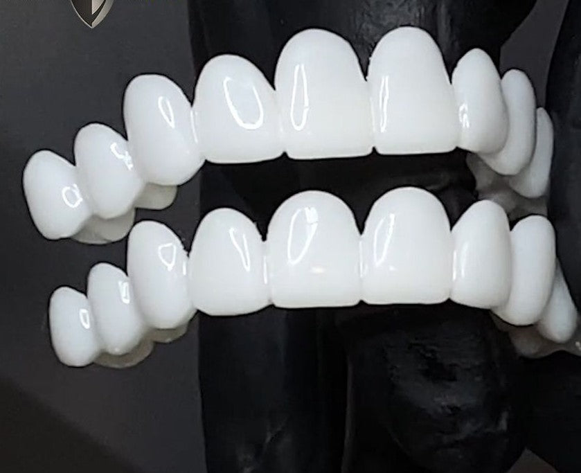 SmileFix Dental Prosthesis - Cosmetic Tooth Overlay – Nzmartys